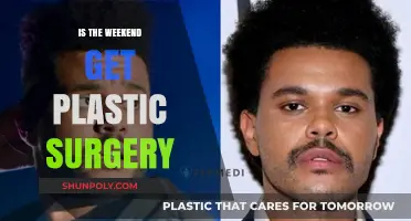 Is The Weeknd's Plastic Surgery Real? Uncovering The Truth | ShunPoly