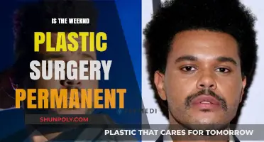 Is The Weeknd's Plastic Surgery Real? Uncovering The Truth | ShunPoly