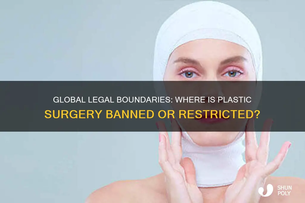 Global Legal Boundaries: Where Is Plastic Surgery Banned Or Restricted ...