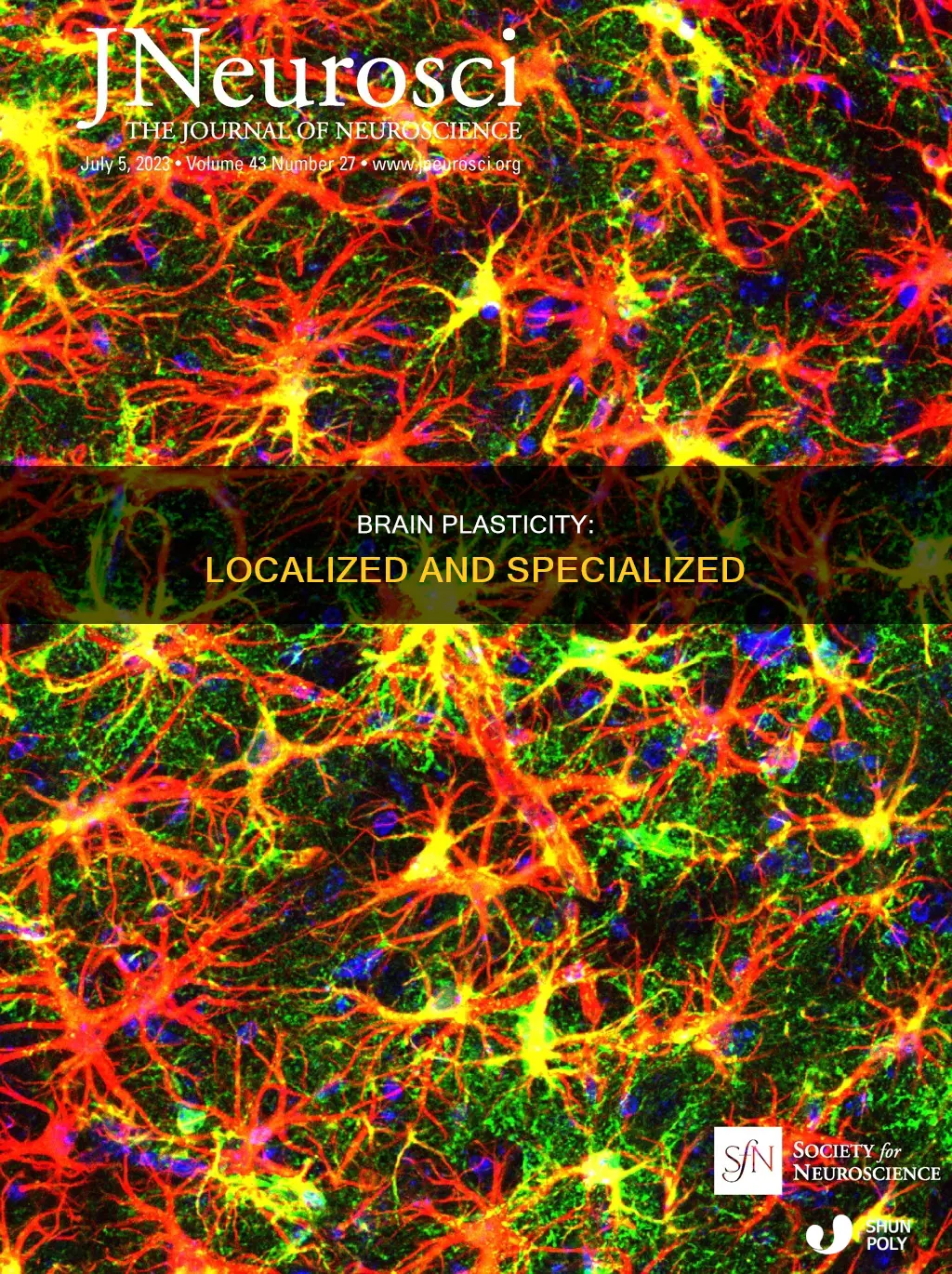 Brain Plasticity: Localized And Specialized | ShunPoly