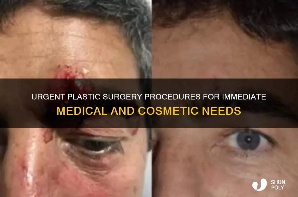 Urgent Plastic Surgery Procedures For Immediate Medical And Cosmetic ...