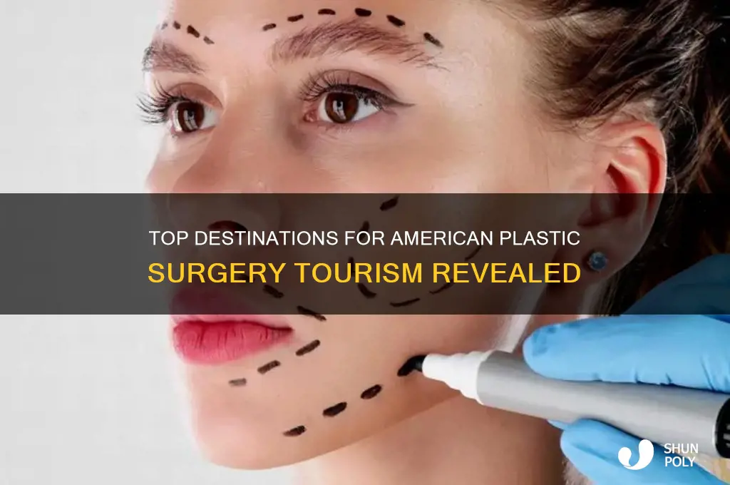 Top Destinations For American Plastic Surgery Tourism Revealed | ShunPoly