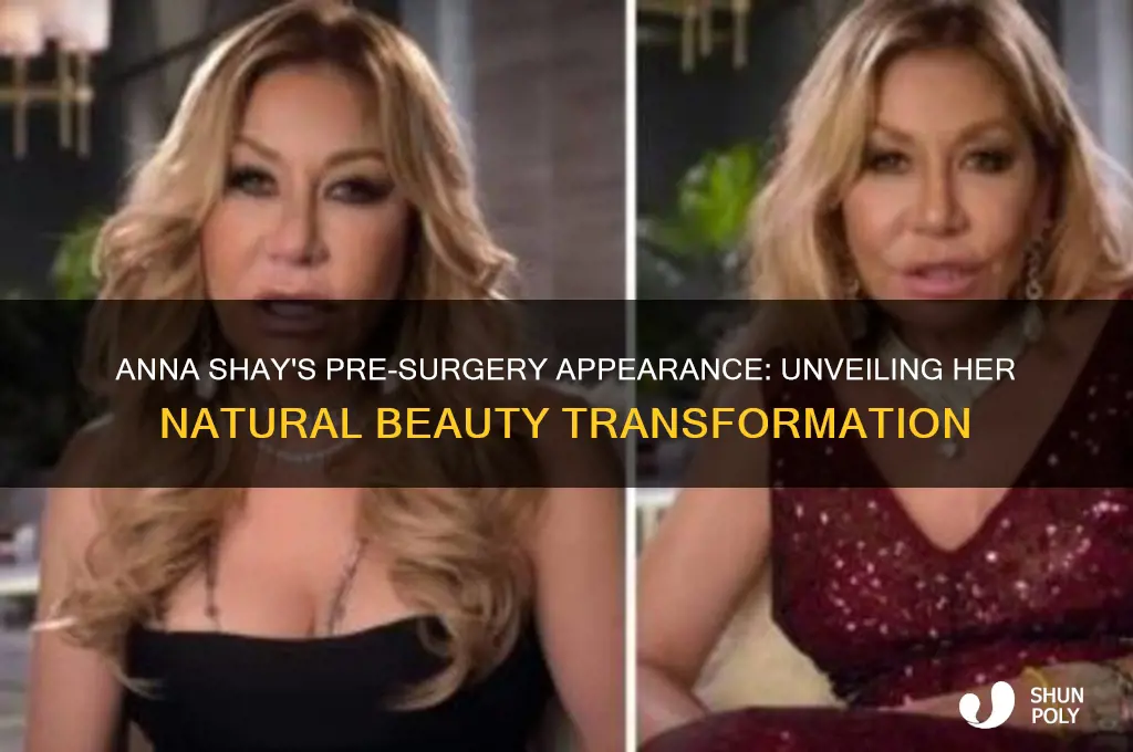Anna Shay's Pre-Surgery Appearance: Unveiling Her Natural Beauty ...