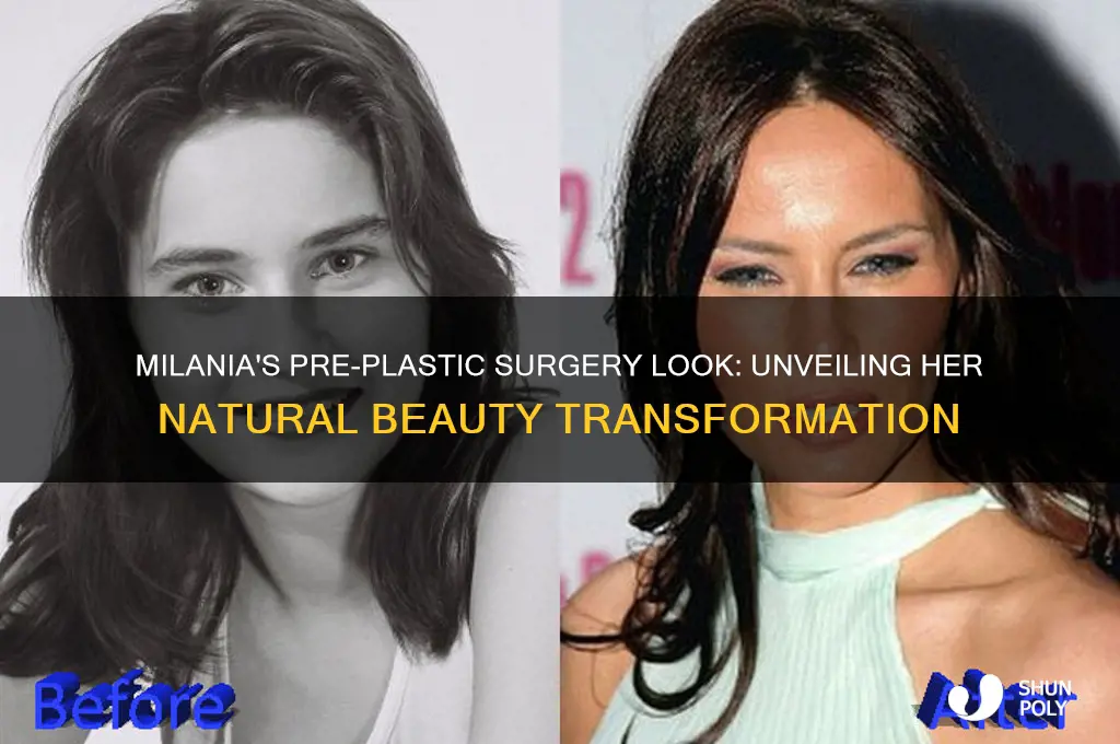 Milania's Pre-Plastic Surgery Look: Unveiling Her Natural Beauty ...