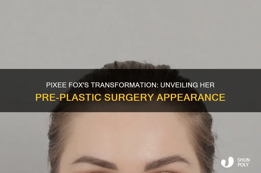 Pixee Fox's Transformation: Unveiling Her Pre-Plastic Surgery ...