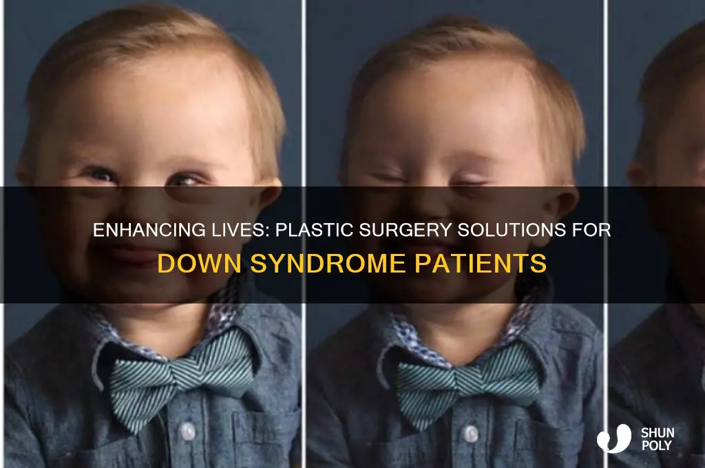 Enhancing Lives: Plastic Surgery Solutions For Down Syndrome Patients ...
