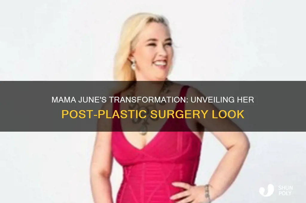 Mama June's Transformation: Unveiling Her Post-Plastic Surgery Look ...