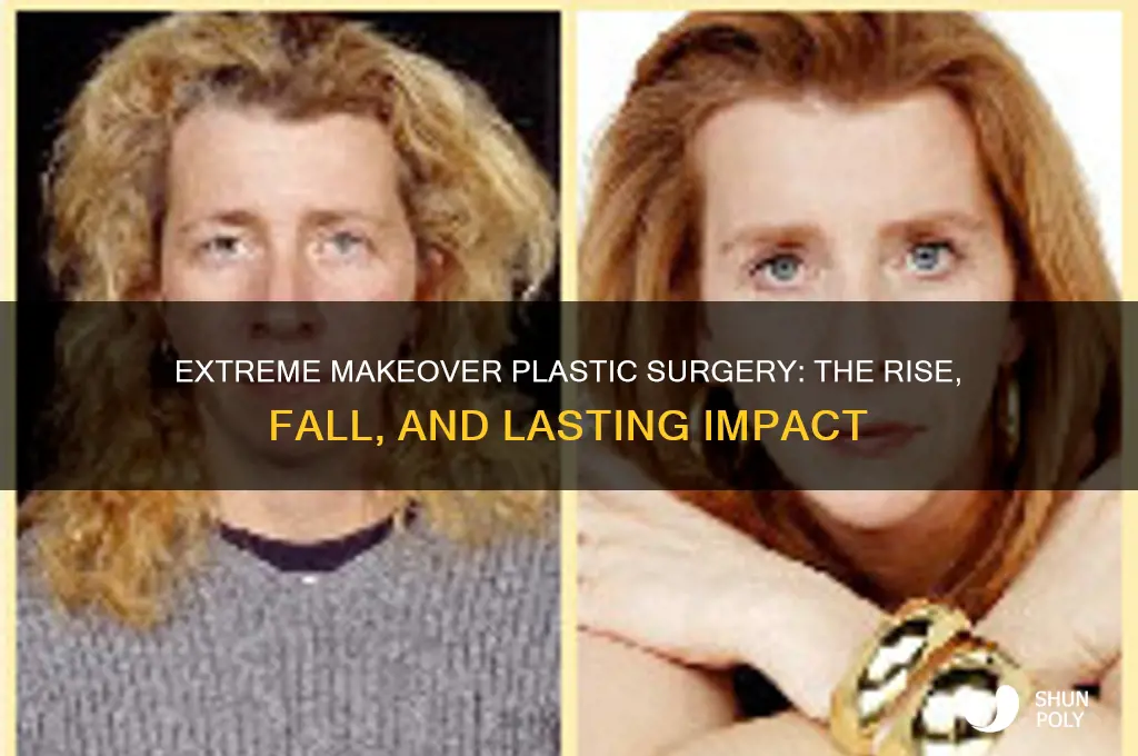 Extreme Makeover Plastic Surgery: The Rise, Fall, And Lasting Impact ...