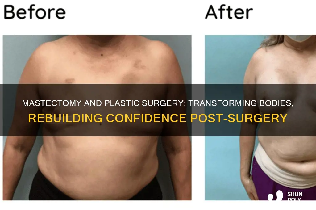 Mastectomy And Plastic Surgery: Transforming Bodies, Rebuilding ...