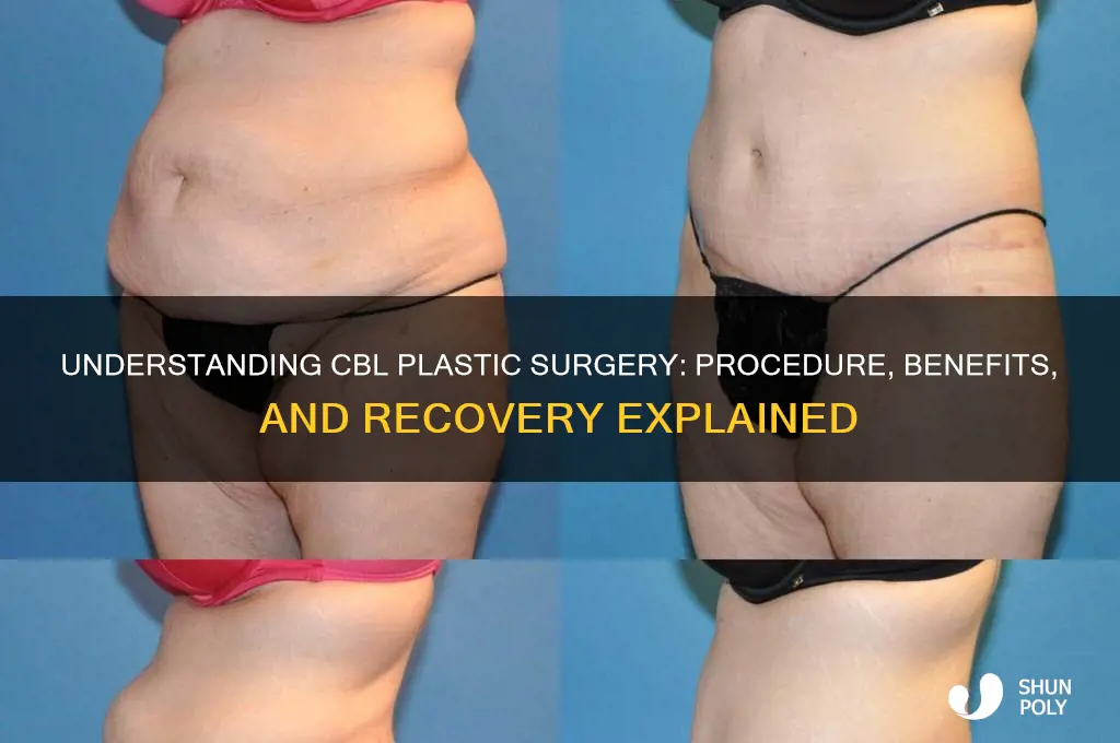 Understanding Cbl Plastic Surgery: Procedure, Benefits, And Recovery ...