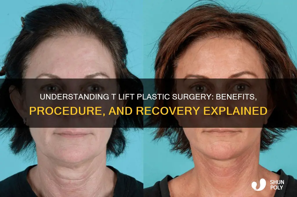 Understanding T Lift Plastic Surgery: Benefits, Procedure, And Recovery ...