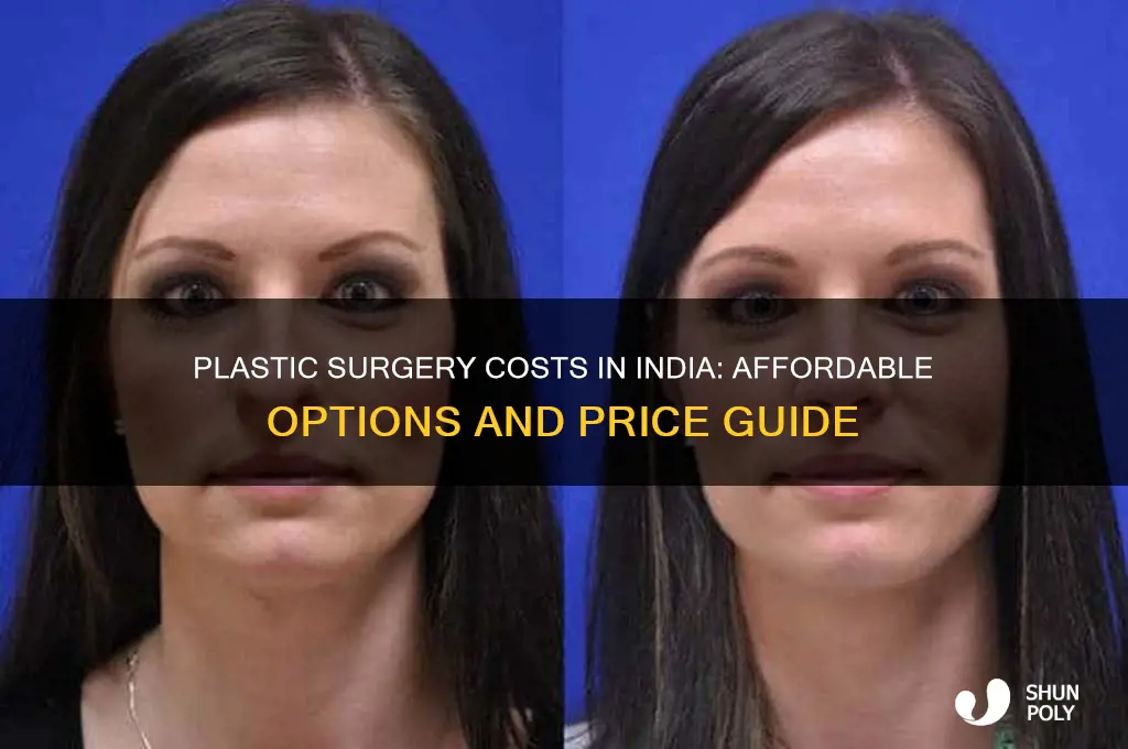 Plastic Surgery Costs In India: Affordable Options And Price Guide ...