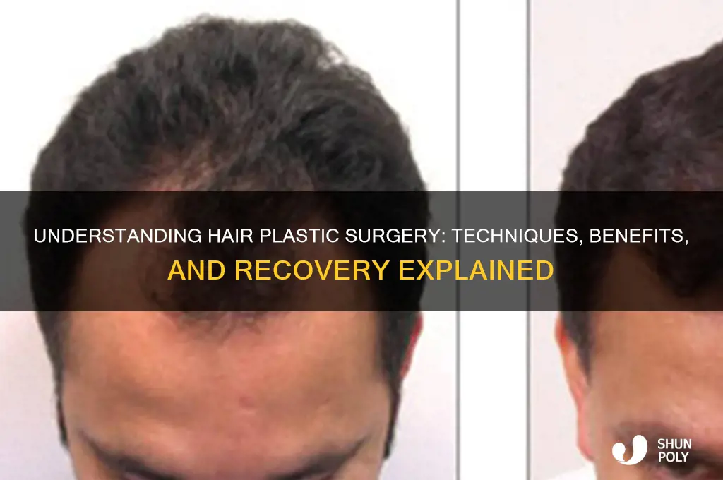 Understanding Hair Plastic Surgery: Techniques, Benefits, And Recovery ...