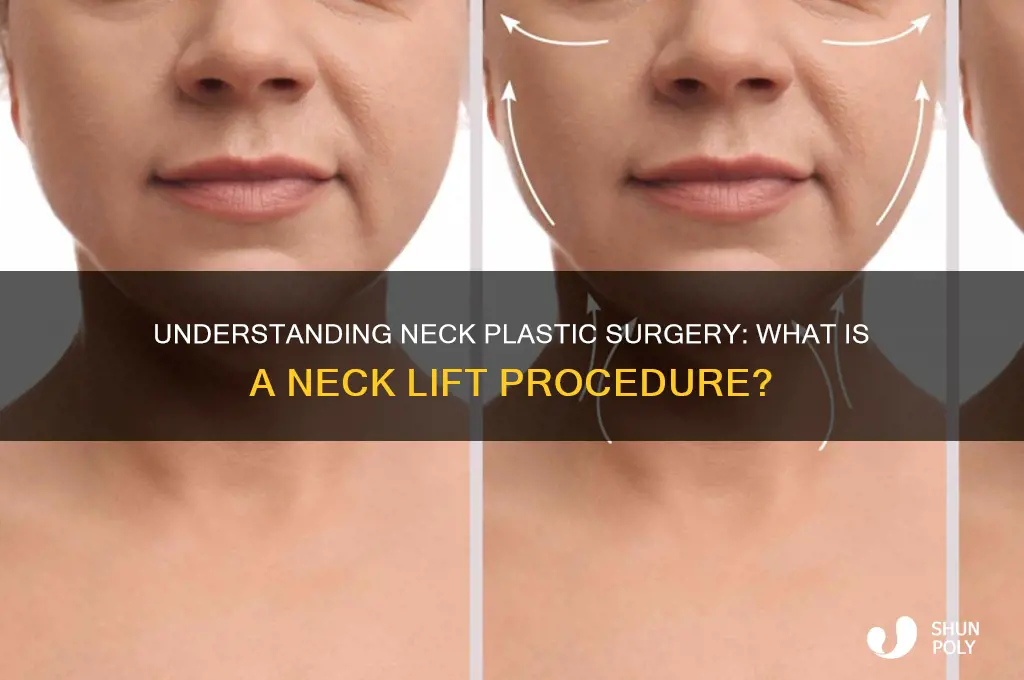 Understanding Neck Plastic Surgery: What Is A Neck Lift Procedure ...