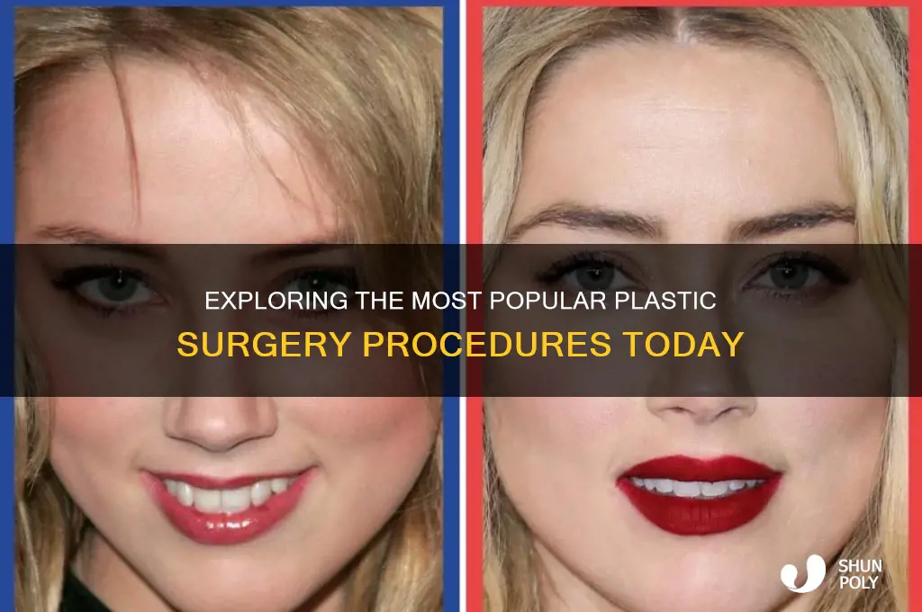 Exploring The Most Popular Plastic Surgery Procedures Today | ShunPoly