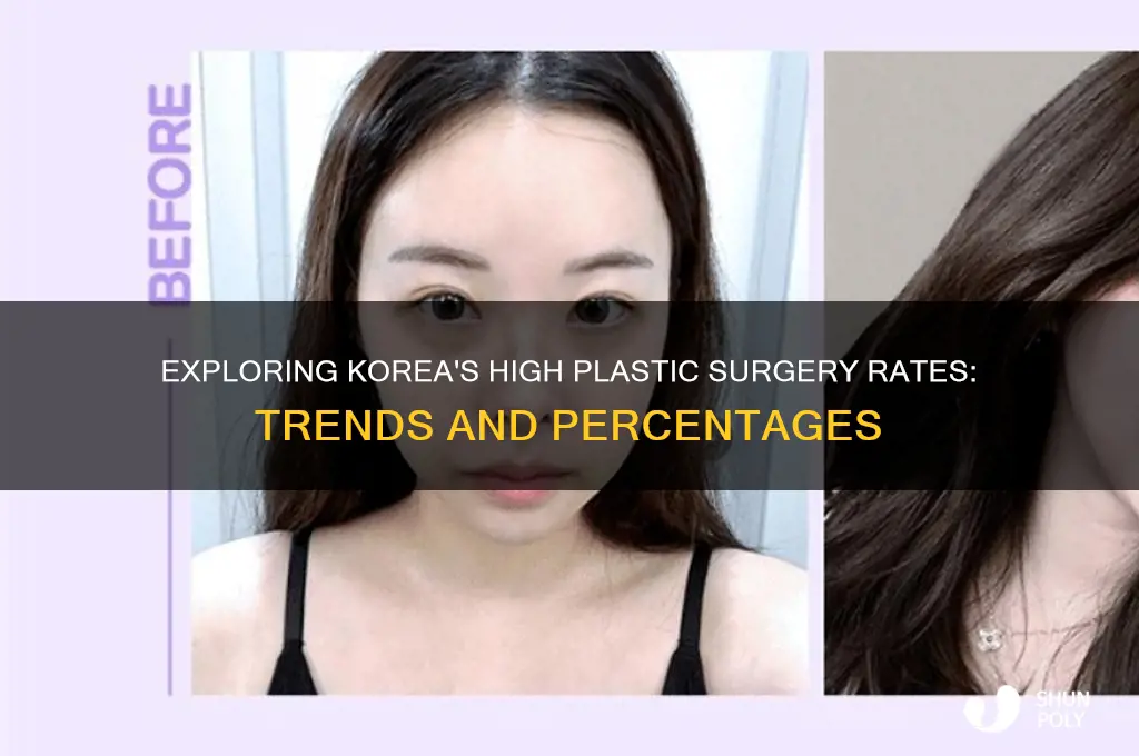 Exploring Korea's High Plastic Surgery Rates: Trends And Percentages ...