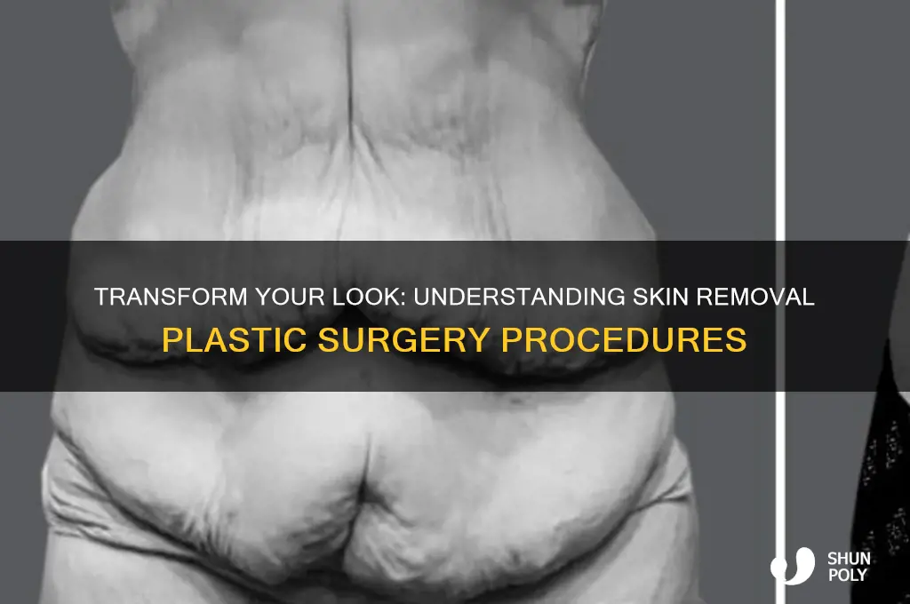 Transform Your Look: Understanding Skin Removal Plastic Surgery ...