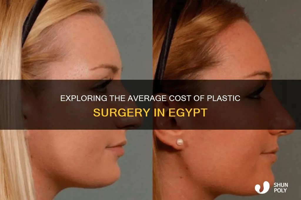 Exploring The Average Cost Of Plastic Surgery In Egypt | ShunPoly