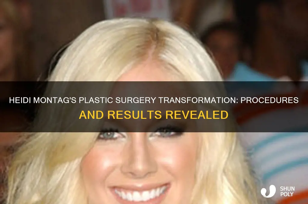Heidi Montag's Plastic Surgery Transformation: Procedures And Results ...