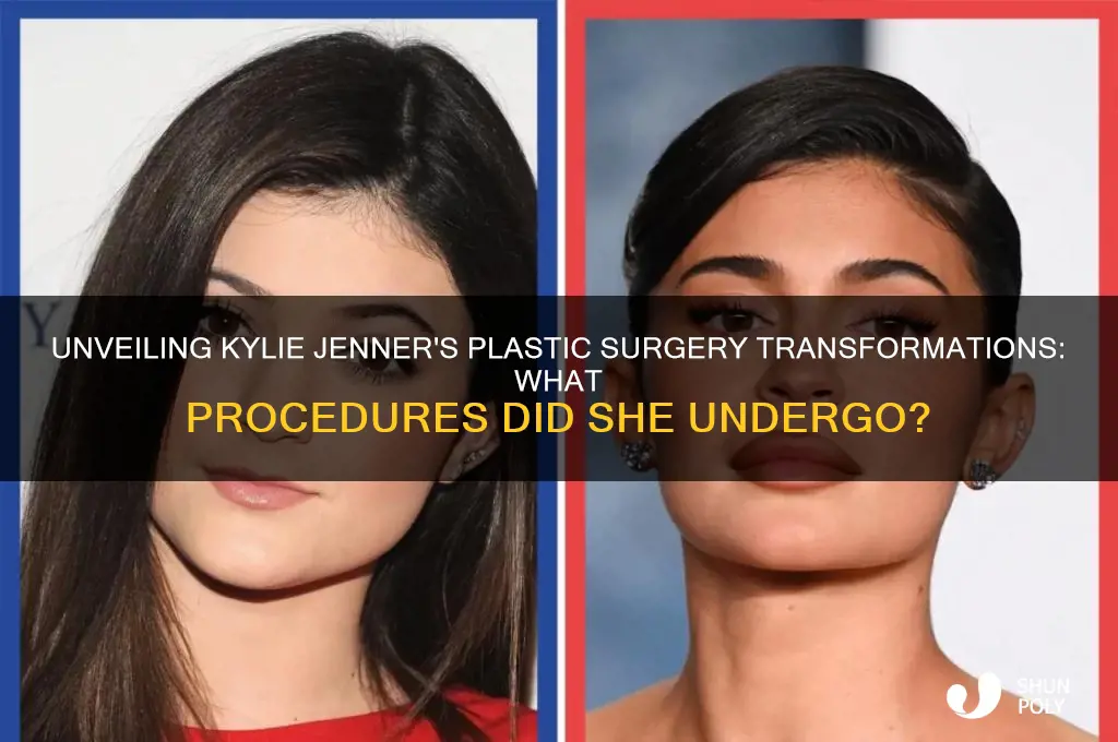 Unveiling Kylie Jenner's Plastic Surgery Transformations: What ...