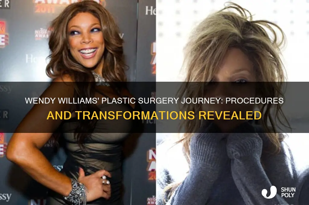 Wendy Williams' Plastic Surgery Journey: Procedures And Transformations ...