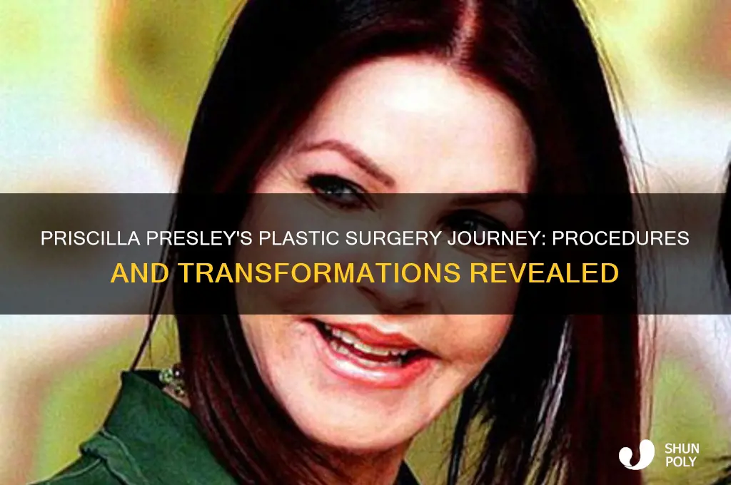 Priscilla Presley's Plastic Surgery Journey: Procedures And ...