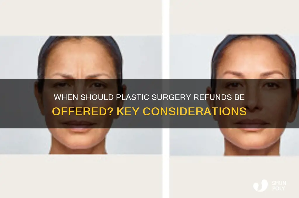 When Should Plastic Surgery Refunds Be Offered? Key Considerations ...