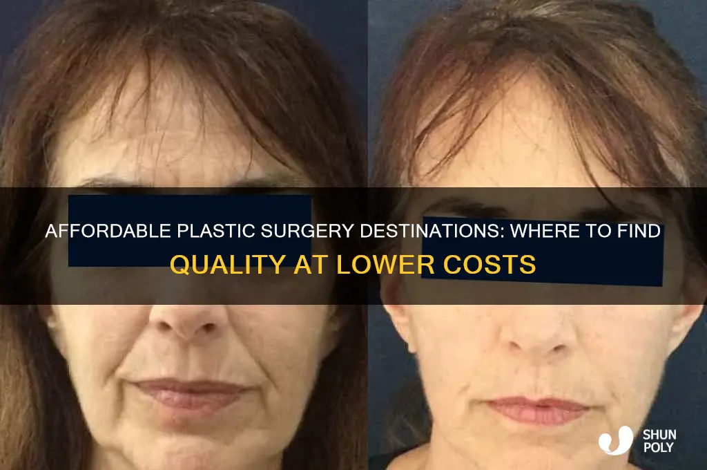 Affordable Plastic Surgery Destinations: Where To Find Quality At Lower ...