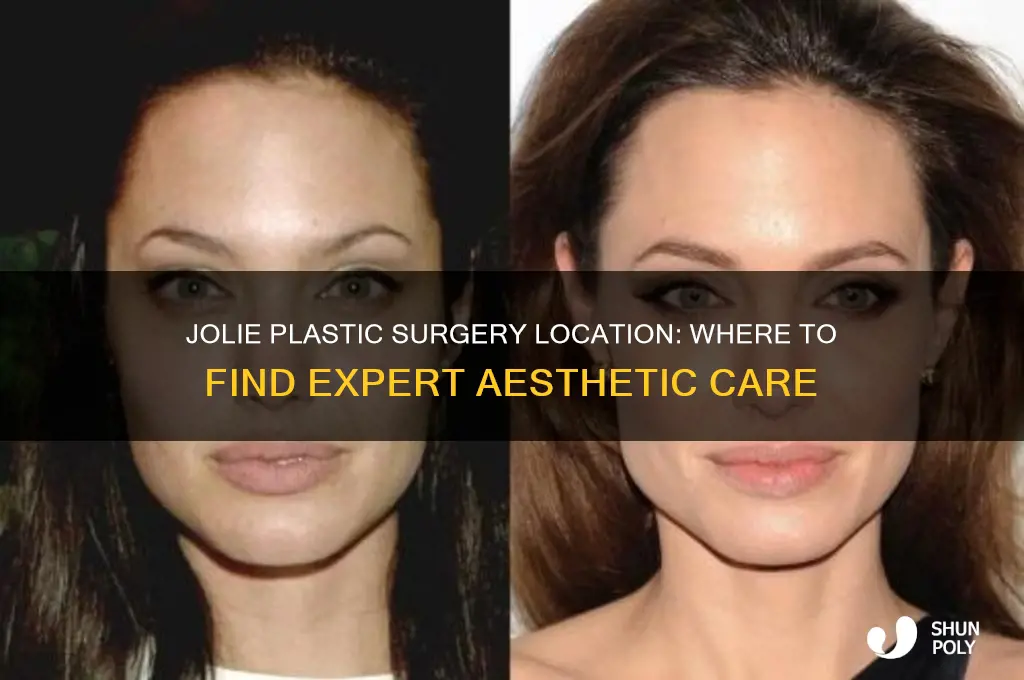 Jolie Plastic Surgery Location: Where To Find Expert Aesthetic Care ...