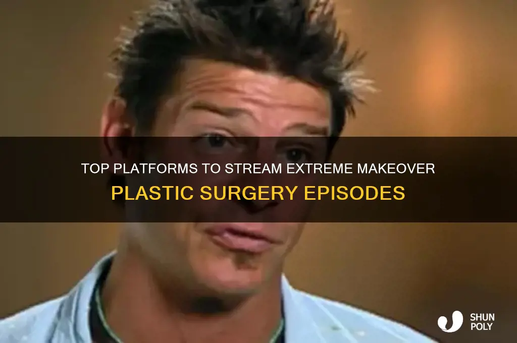 Top Platforms To Stream Extreme Makeover Plastic Surgery Episodes ...