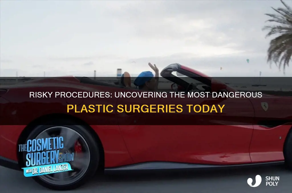 Risky Procedures: Uncovering The Most Dangerous Plastic Surgeries Today ...