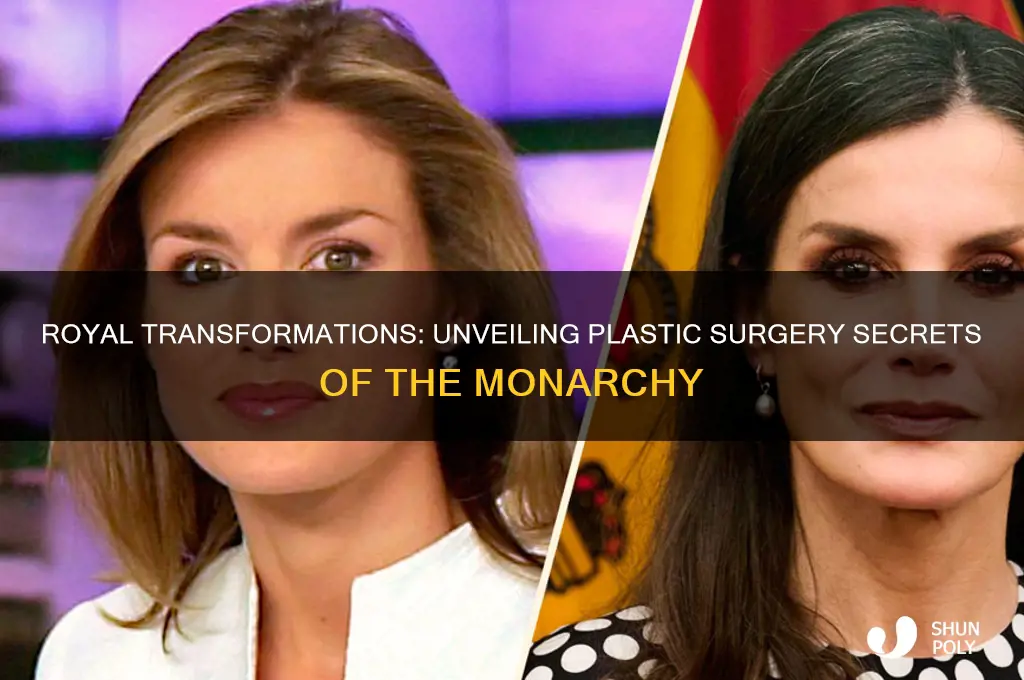 Royal Transformations: Unveiling Plastic Surgery Secrets Of The ...