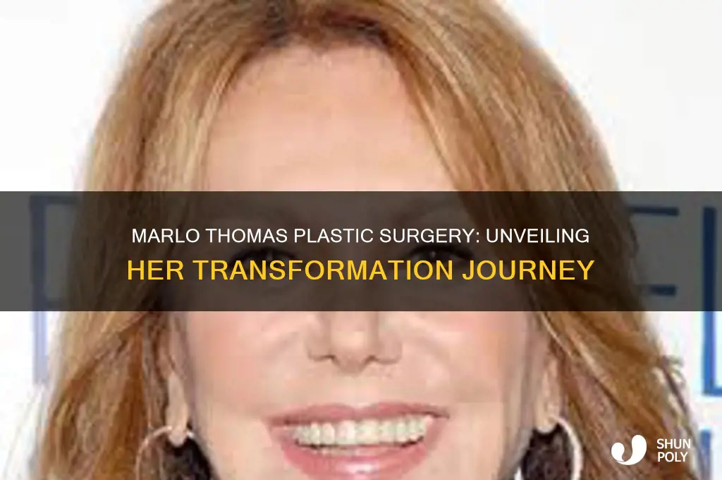 Marlo Thomas Plastic Surgery: Unveiling Her Transformation Journey ...