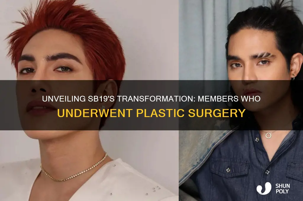 Unveiling Sb19's Transformation: Members Who Underwent Plastic Surgery ...