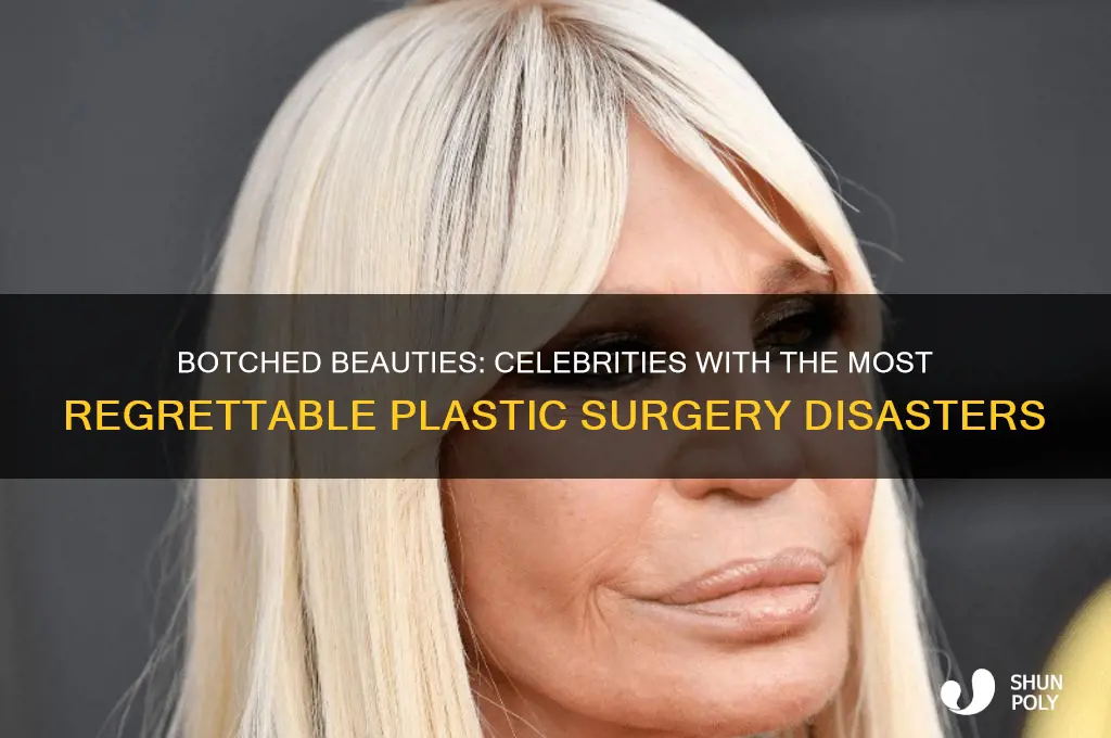Botched Beauties: Celebrities With The Most Regrettable Plastic Surgery ...