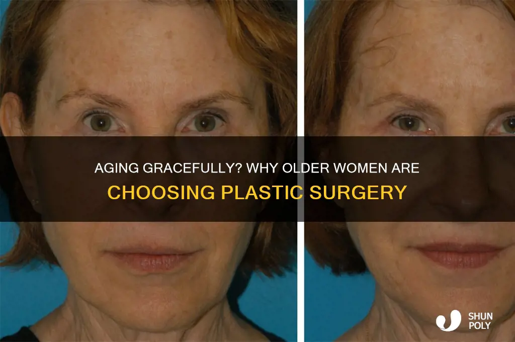 Aging Gracefully? Why Older Women Are Choosing Plastic Surgery | ShunPoly