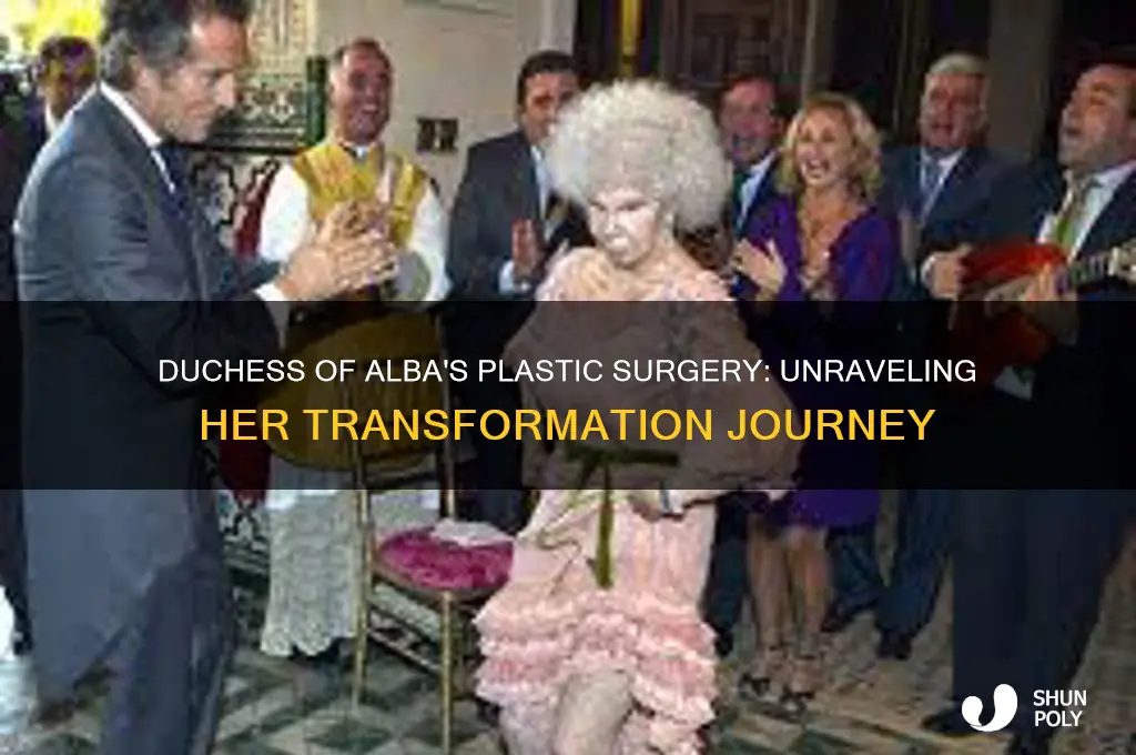 Duchess Of Alba's Plastic Surgery: Unraveling Her Transformation ...