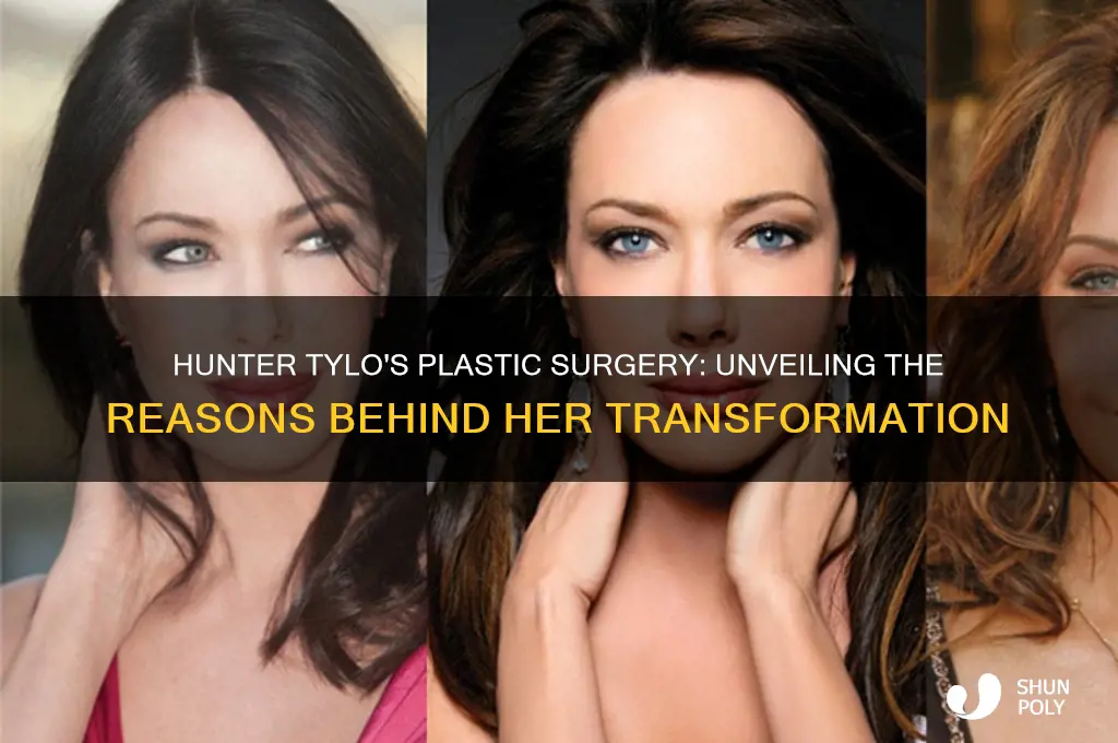 Hunter Tylo's Plastic Surgery: Unveiling The Reasons Behind Her ...