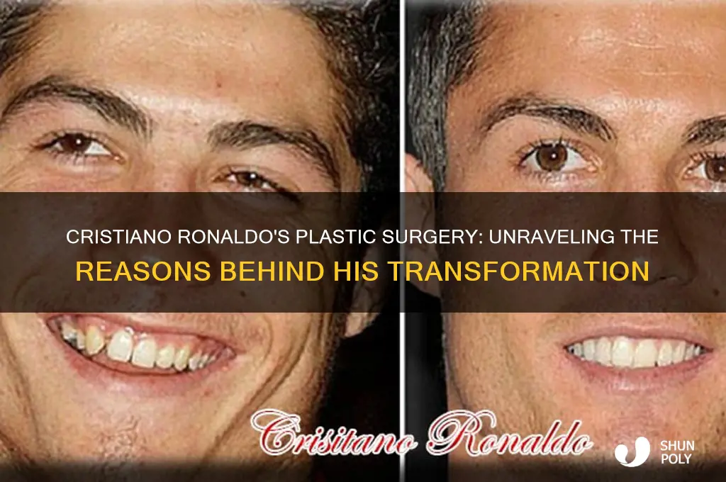 Cristiano Ronaldo's Plastic Surgery: Unraveling The Reasons Behind His ...
