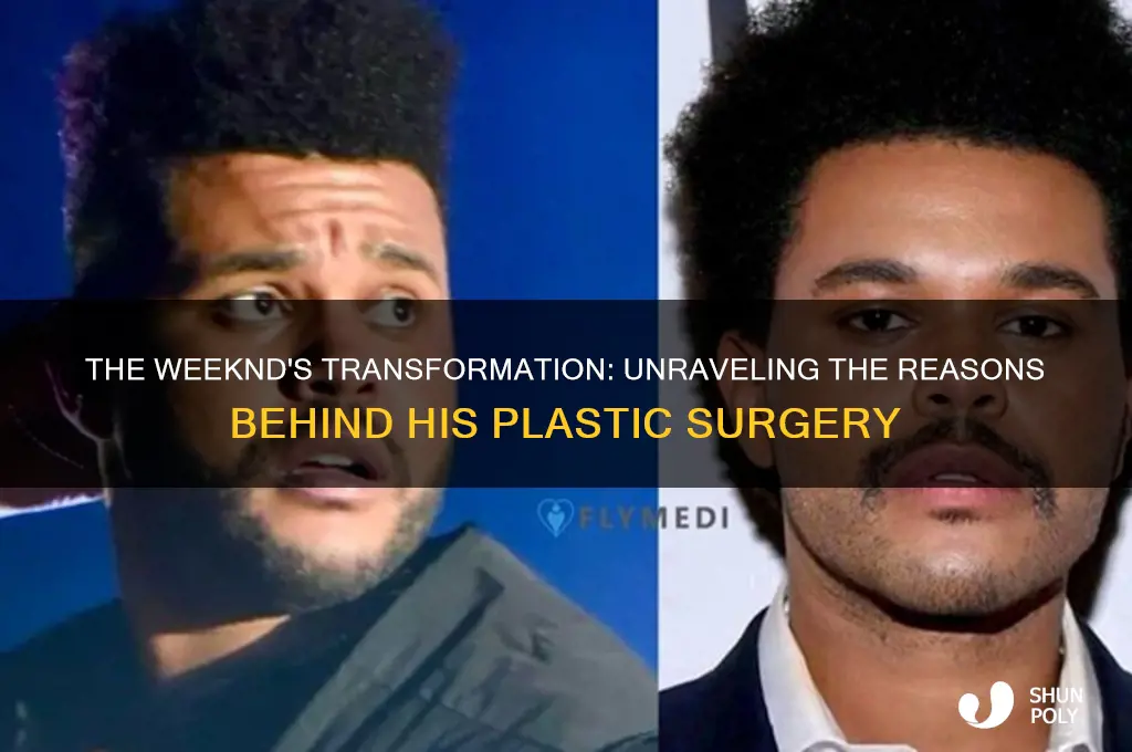 The Weeknd's Transformation: Unraveling The Reasons Behind His Plastic ...