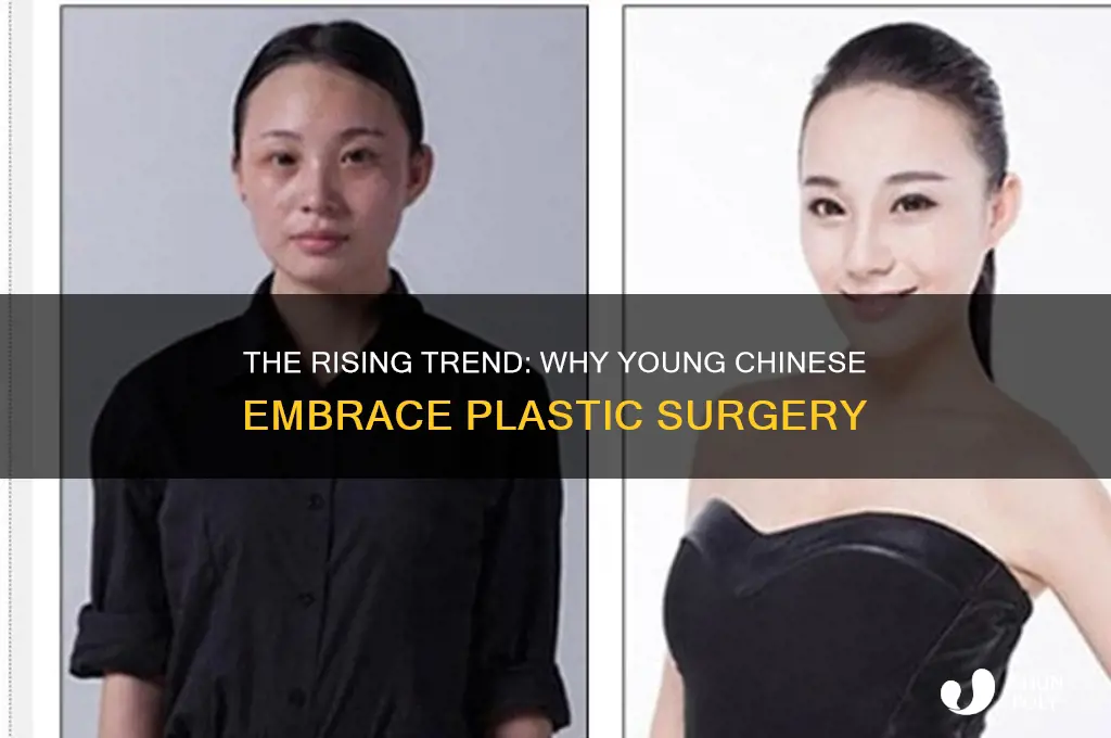 The Rising Trend: Why Young Chinese Embrace Plastic Surgery | ShunPoly