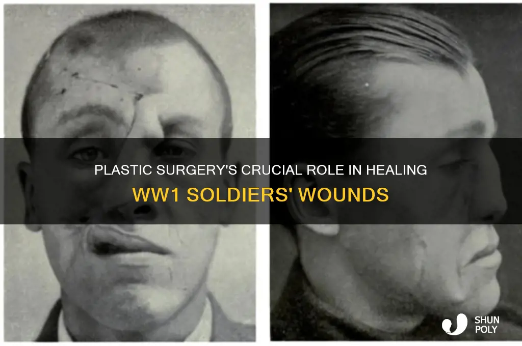 Plastic Surgery's Crucial Role In Healing Ww1 Soldiers' Wounds | ShunPoly